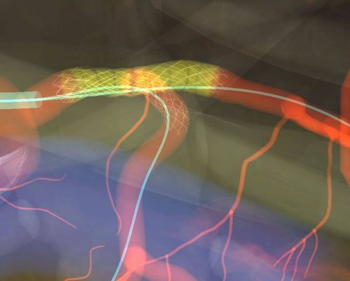 Coronary Advanced | Software